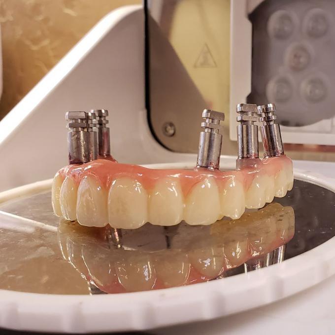 Mono Dental Pmma Block Monochromatic Pmma Temporary Bridge 98mm