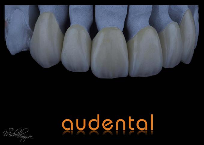 Gradient Dental Zirconia Block 3D Pro 9 Layers Zirconia Milling Disc