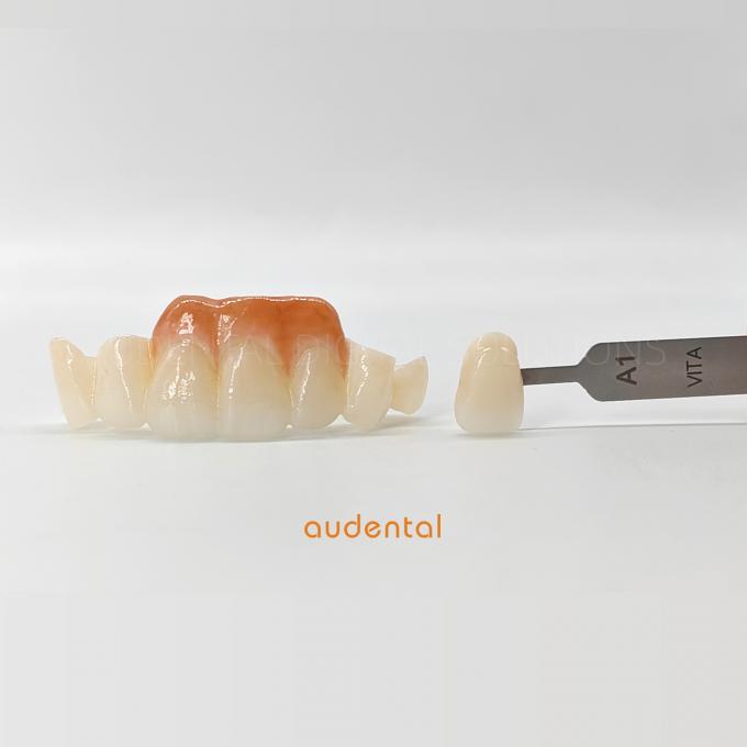 Audental 3D Pro Zirconia Block Indication-Full Contour Bridge